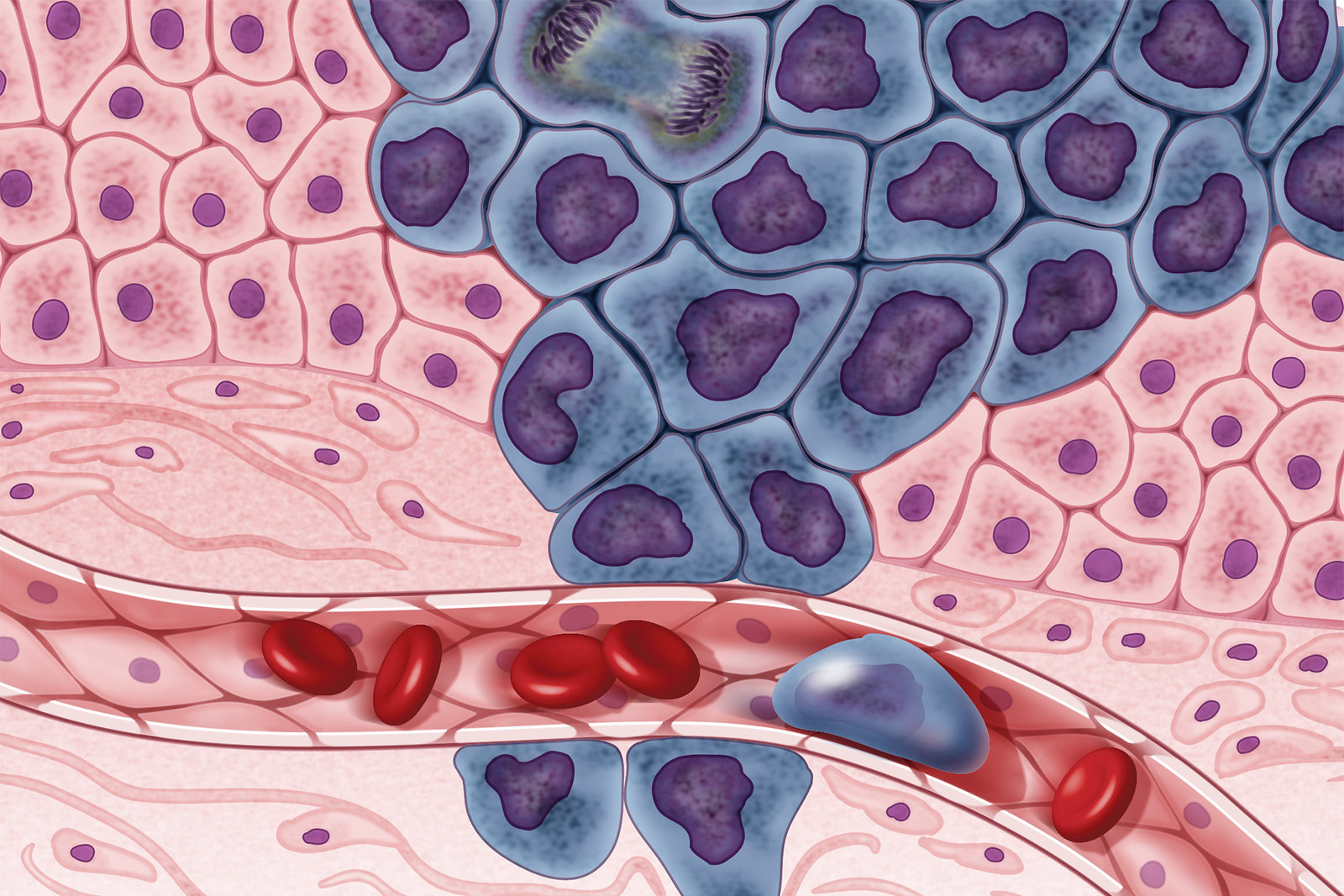 Single Cell Rna Sequencing Enhances Understanding Of Tumor Genetic 6846